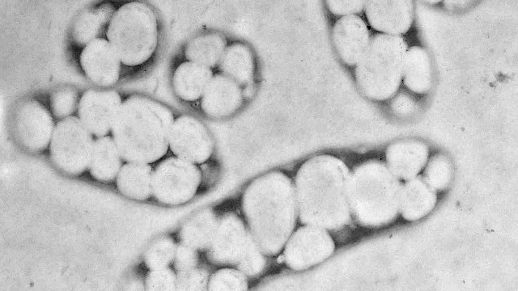 ¿Qué es la Nanobiotecnología? | Uniandes